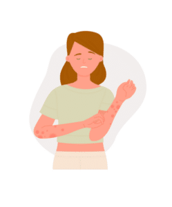 Orticaria da stress: cos'è, sintomi, cause e cura - Anna Rossoni